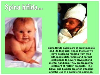 6-Birth-Defects.ppt