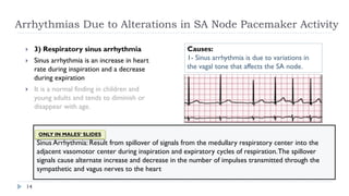 6- Cardiac Arrhythmias .pdf is a disease | PPT