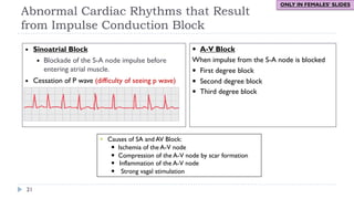 6- Cardiac Arrhythmias .pdf is a disease | PDF