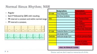 6- Cardiac Arrhythmias .pdf is a disease | PDF