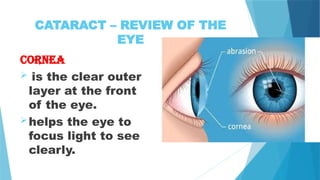 6-CATARACT.pptx perception in nursing ..... | PPTX