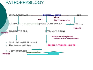 Chemical-burn | PPT