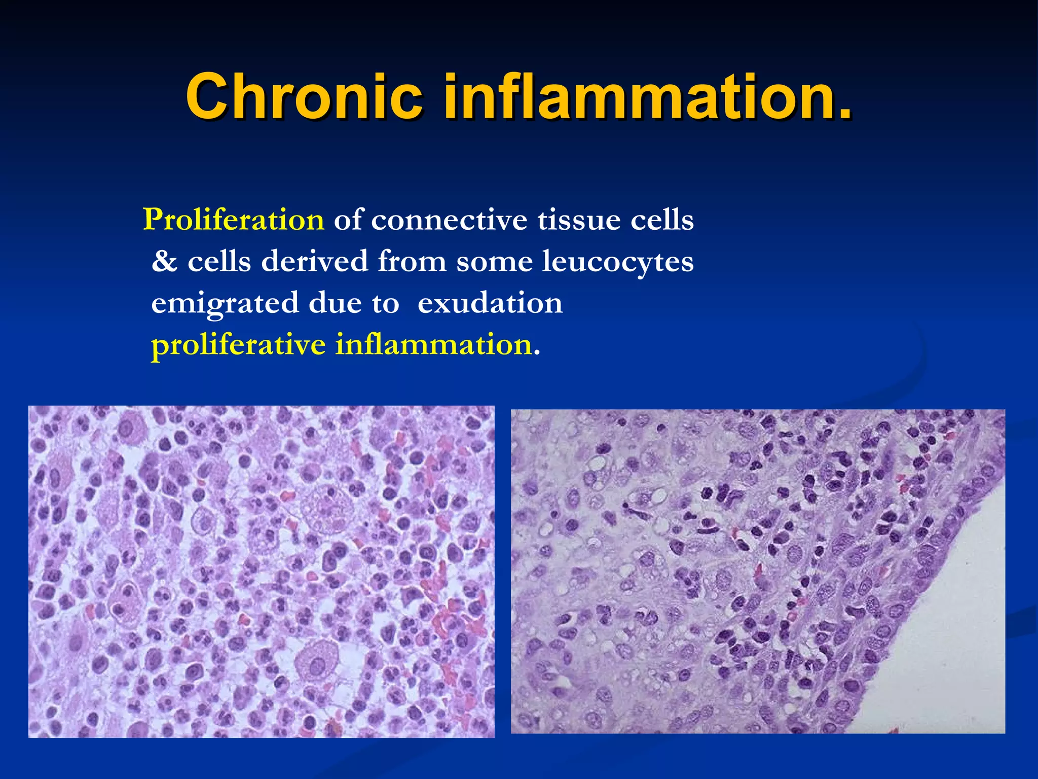 pat anat-chronic inflamation | PPT
