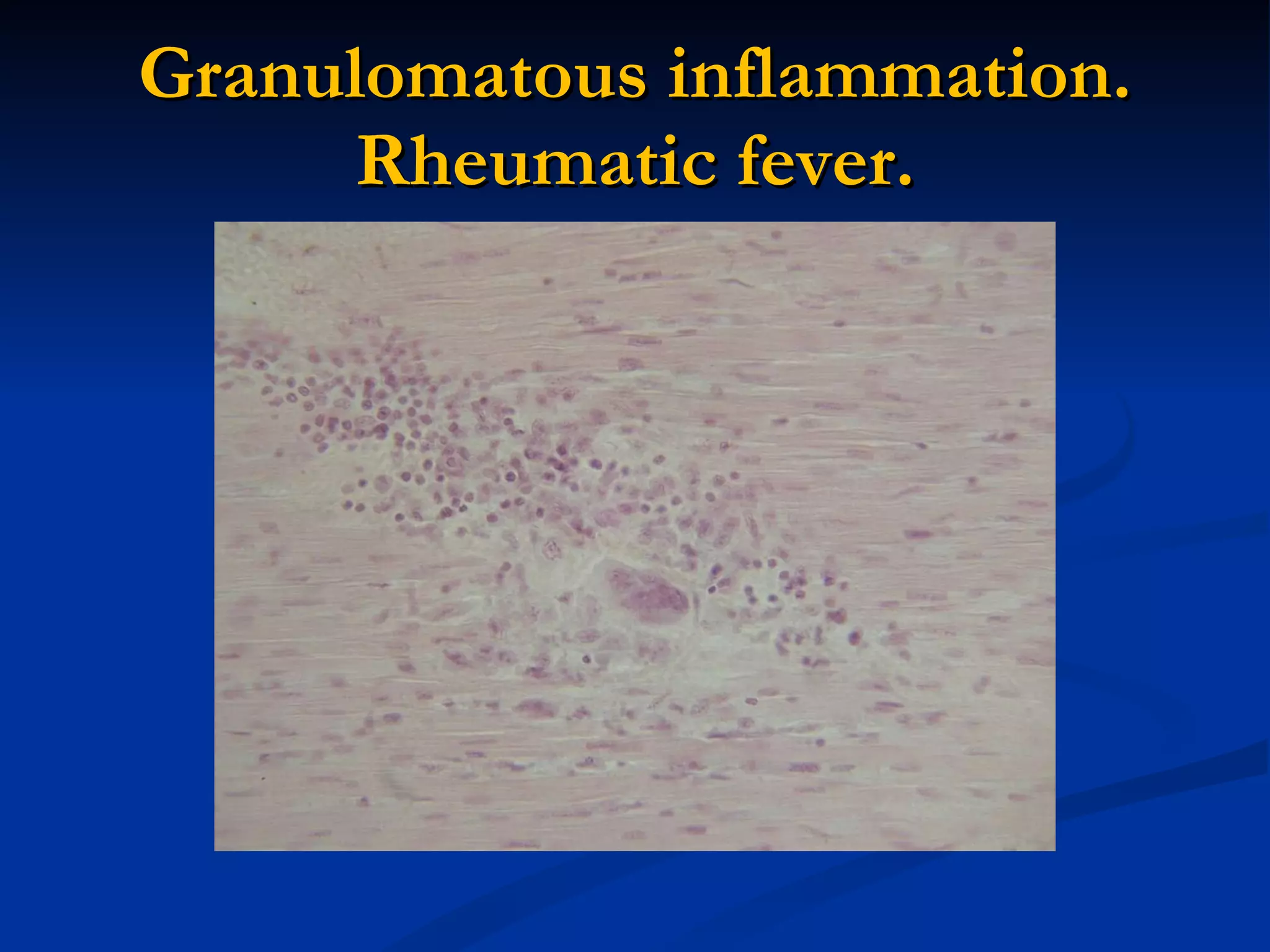 pat anat-chronic inflamation | PPT