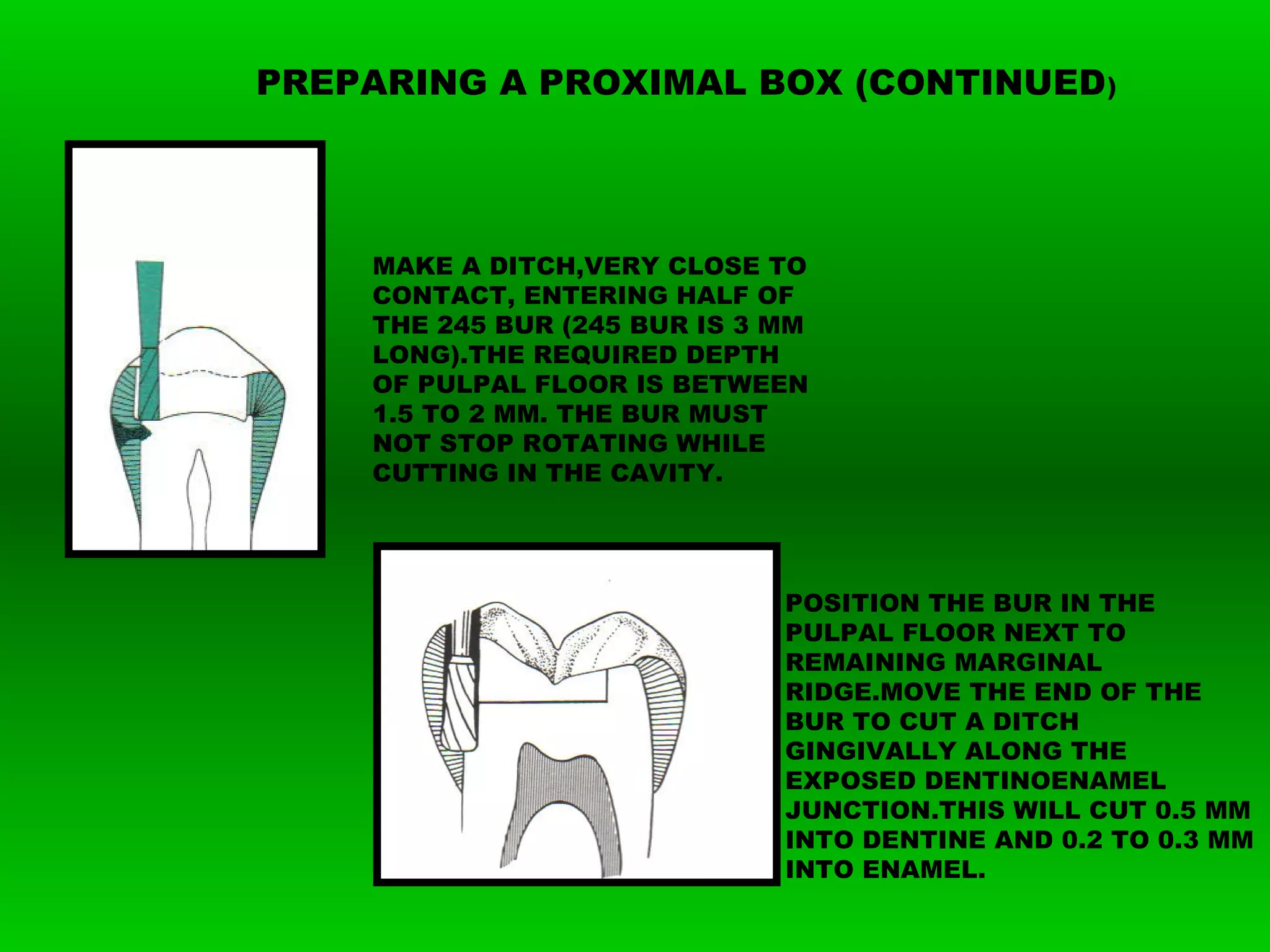 Class II Amalgam Preparation | PPT