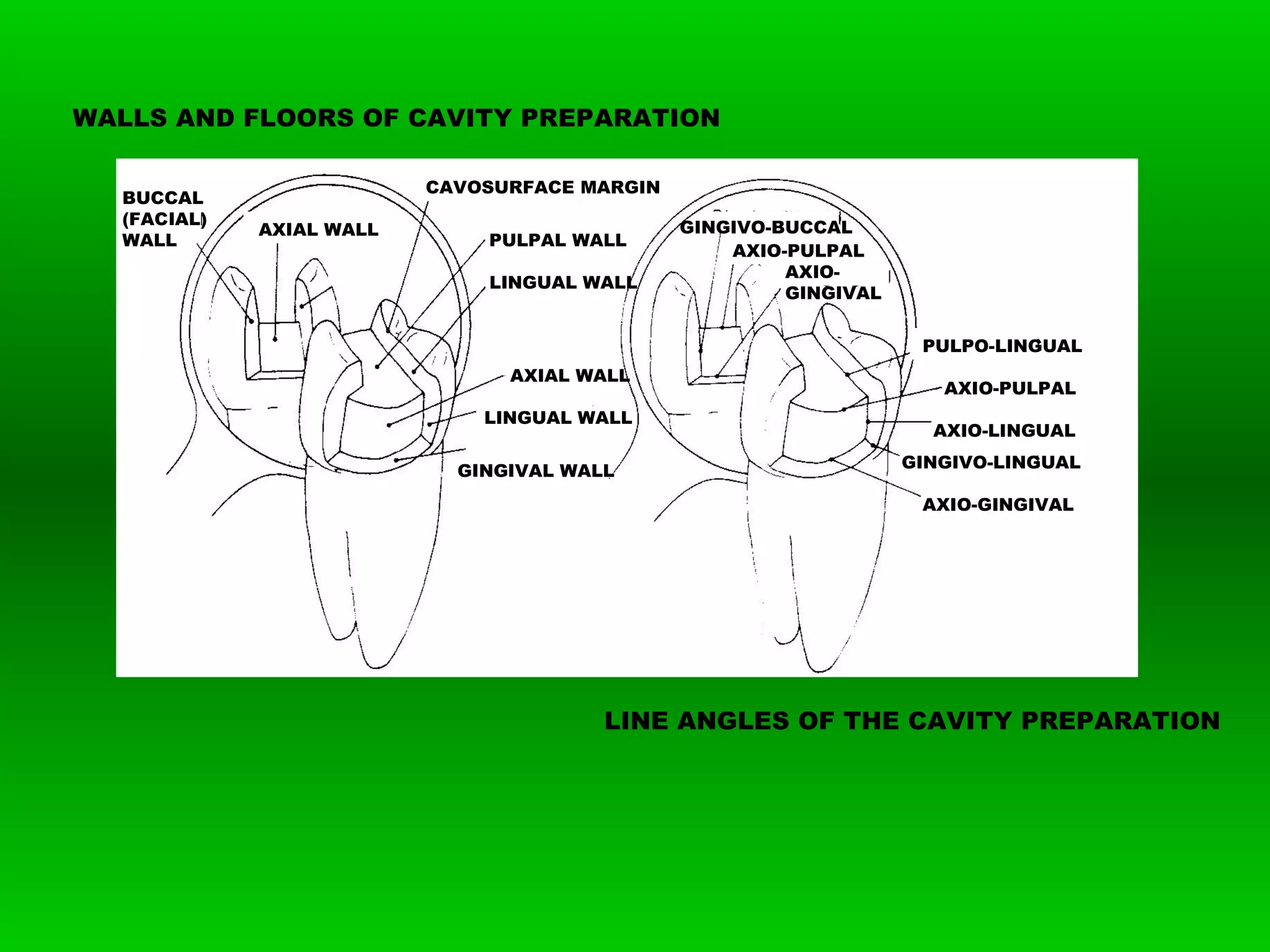 Class II Amalgam Preparation | PPT