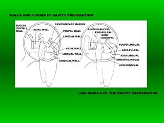 Class II Amalgam Preparation | PPT