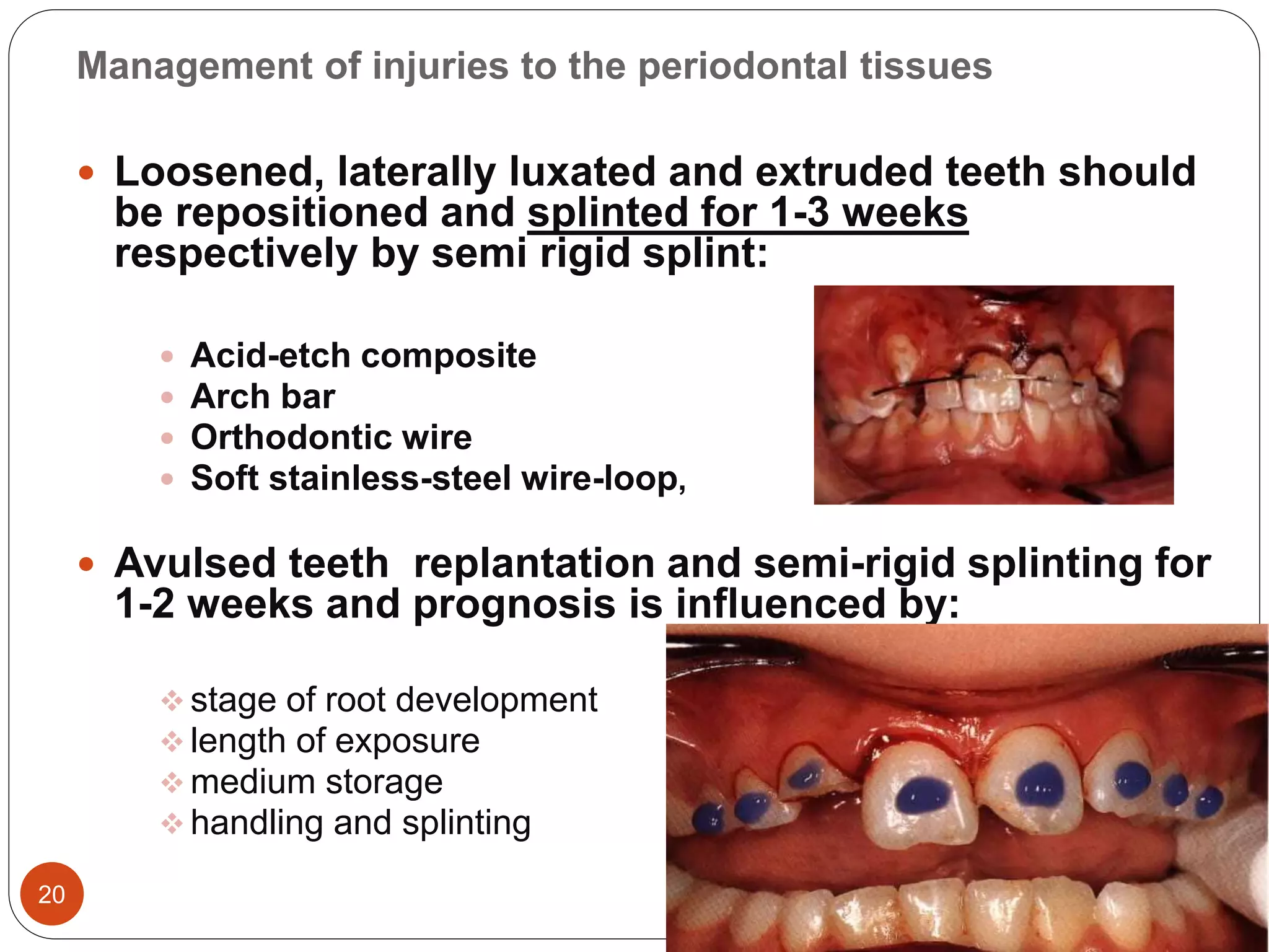 6-Dento-alveolar fractures.ppt