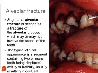 6-Dento-alveolar fractures.ppt