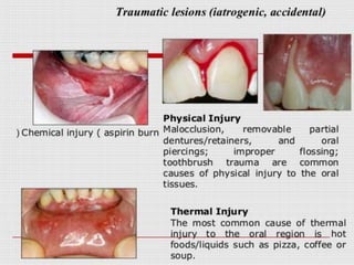 6-Dento-alveolar fractures.ppt