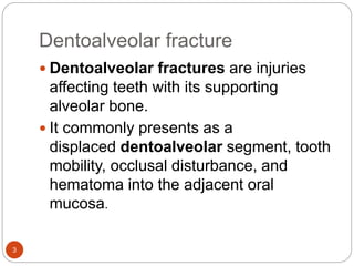 6-Dento-alveolar fractures.ppt