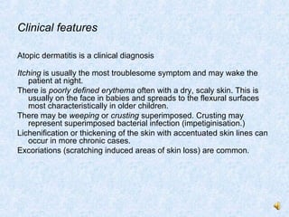6. dermatitis and its variants | PPT