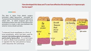 Lap. Tapp Made Easy Using The Innovative Tumescent Technique | PPTX