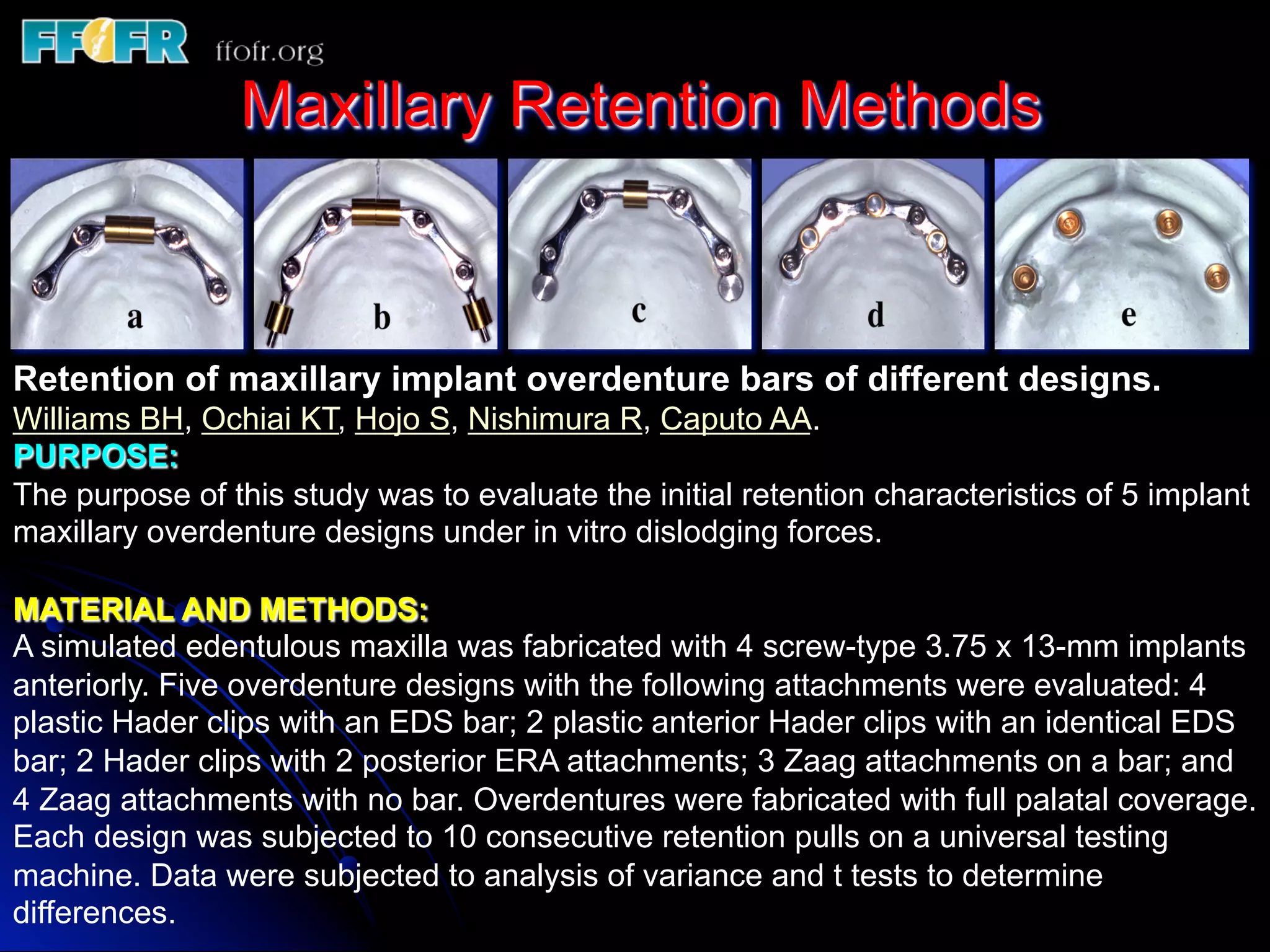 Edentulous Maxilla - Overlay Dentures | PDF