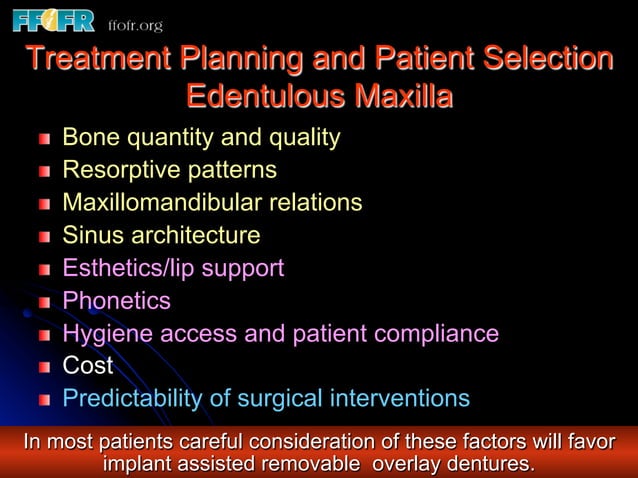 Edentulous Maxilla - Overlay Dentures | PDF