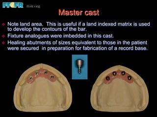 Edentulous Maxilla - Overlay Dentures | PDF
