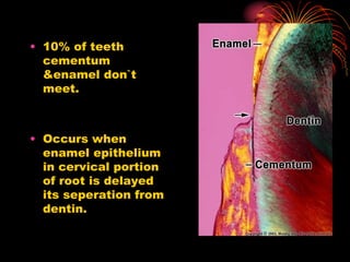 Structure of the first layer of tooth Enamel .ppt