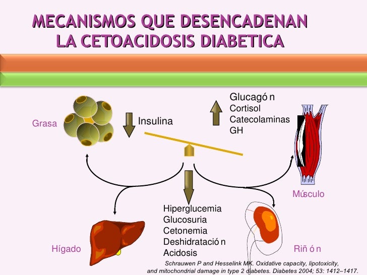Etiología de Cetoacidosis Diabética