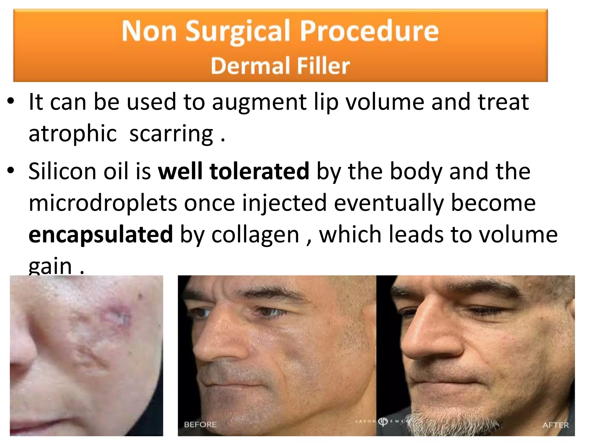 lecture 1 facial cosmatic surgery | PPTX