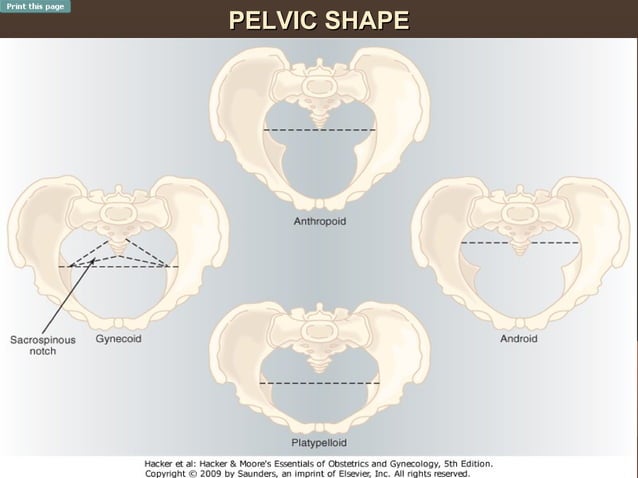 fetus and gynaecoid pelvis | PPT | Pregnancy | Reproductive Health