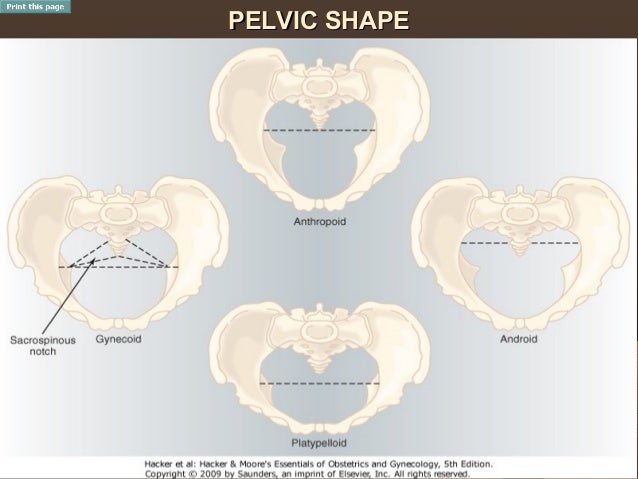 Gynaecoid Pelvis Practical Advice : Pelvic Pain In Pregnancy — Body