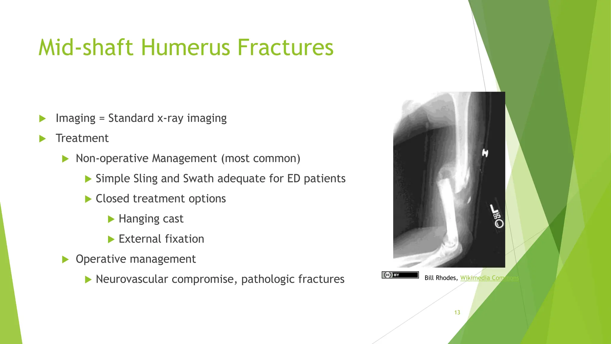 Fracture of upper limb and physical thet | PPTX