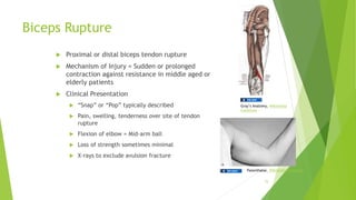 Fracture of upper limb and physical thet | PPTX