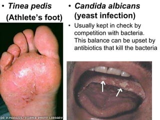 materi matakuliah mikologi dasar 6-fungi.ppt