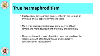 True Hermaphroditism In Humans
