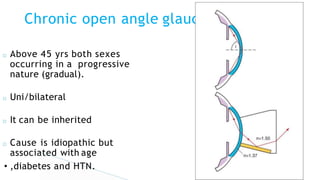 6-Glaucoma and Anterior Segment Diseases.pptx