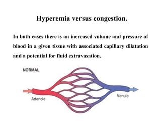 6 hemodynamic disorders | PDF