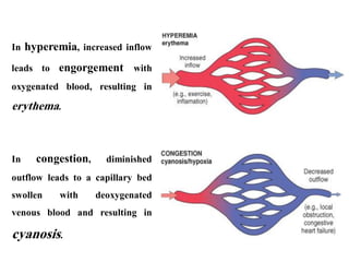 6 hemodynamic disorders | PDF