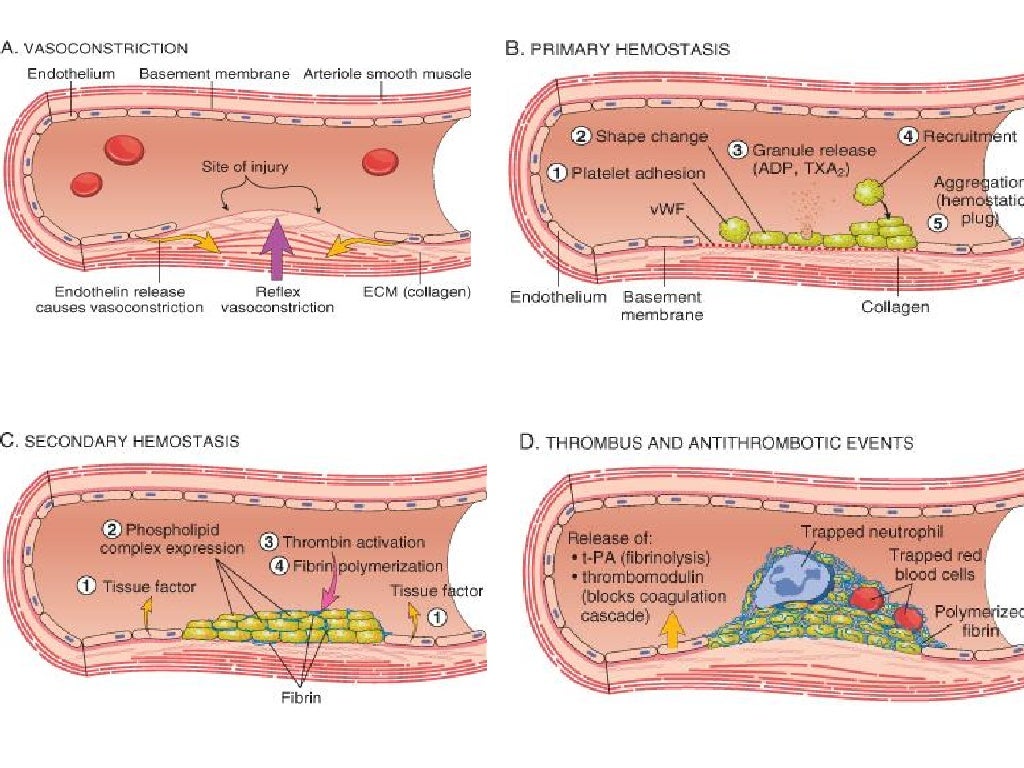 6 hemodynamic disorders