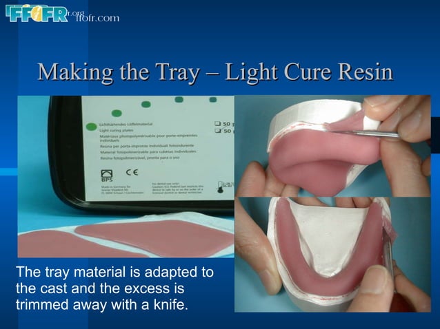 6. impression tray fabrication | PPT | Oral care | Personal Care