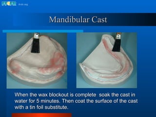 6. impression tray fabrication | PPT