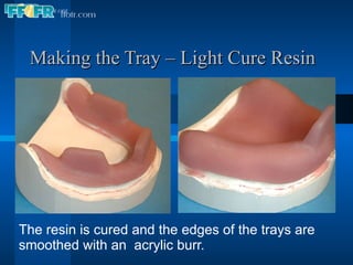 6. impression tray fabrication | PPT
