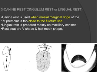 6-indirectretainers-200630121301.pdf