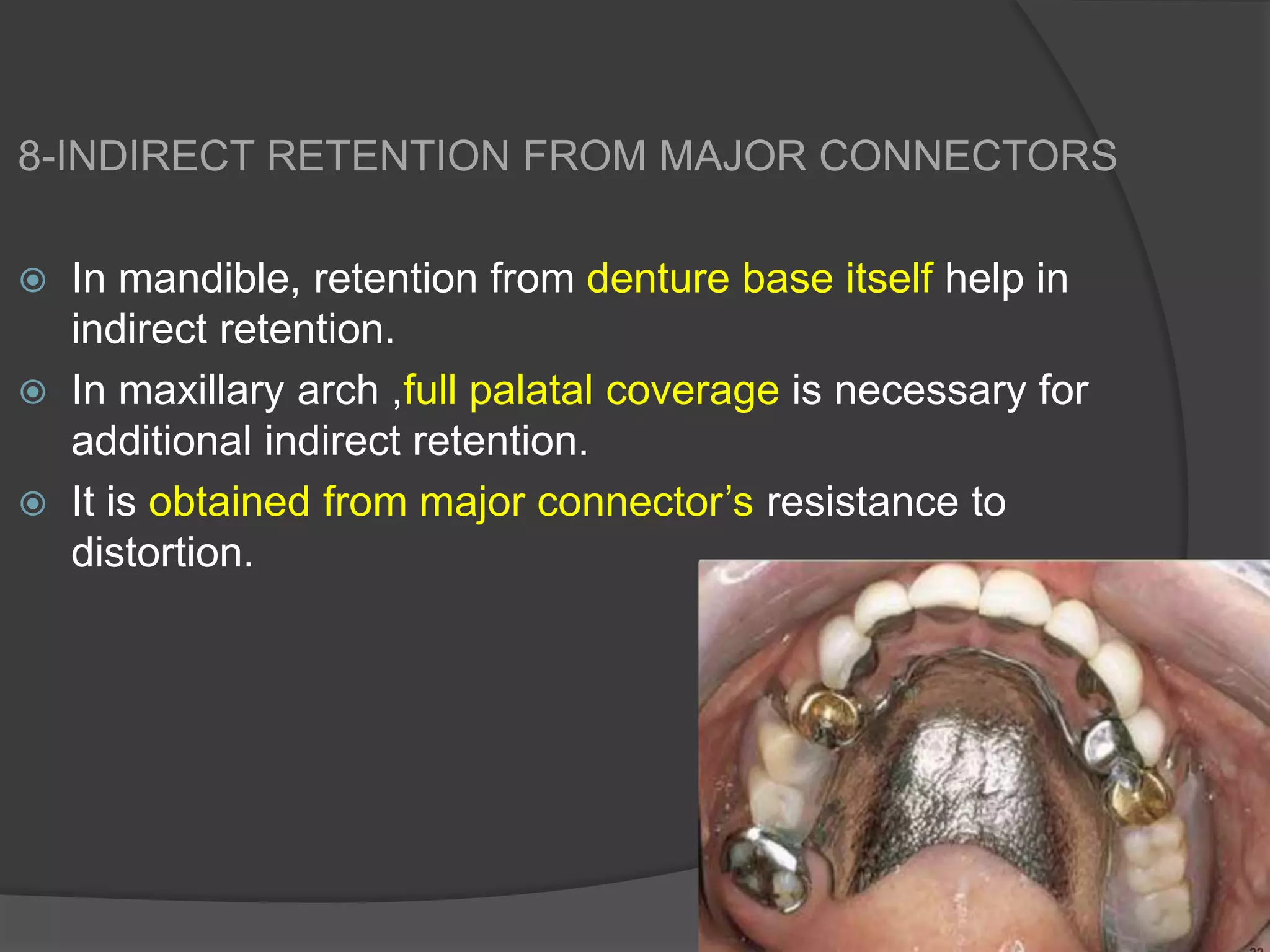 INDIRECT RETAINERS IN REMOVABLE PARTIAL DENTURES | PPTX