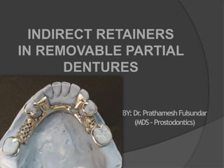 INDIRECT RETAINERS IN REMOVABLE PARTIAL DENTURES | PPTX