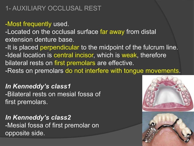 INDIRECT RETAINERS IN REMOVABLE PARTIAL DENTURES | PPTX | Dental Health ...