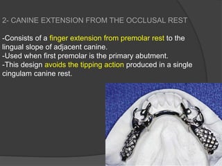 INDIRECT RETAINERS IN REMOVABLE PARTIAL DENTURES | PPTX