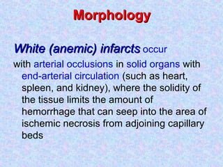 6 infarction | PPT