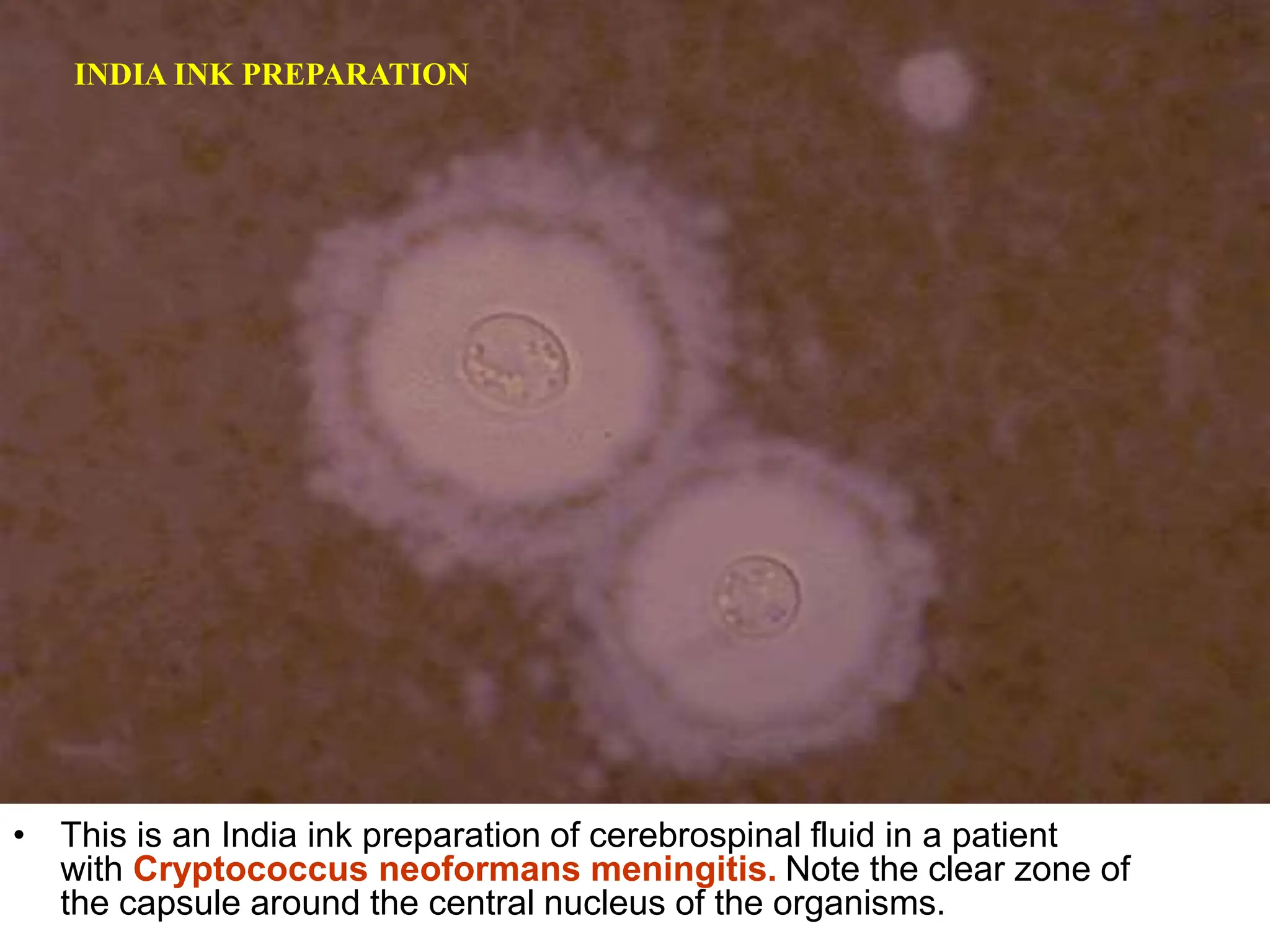 6-INFECTIONS pathology power point presentation | PPT