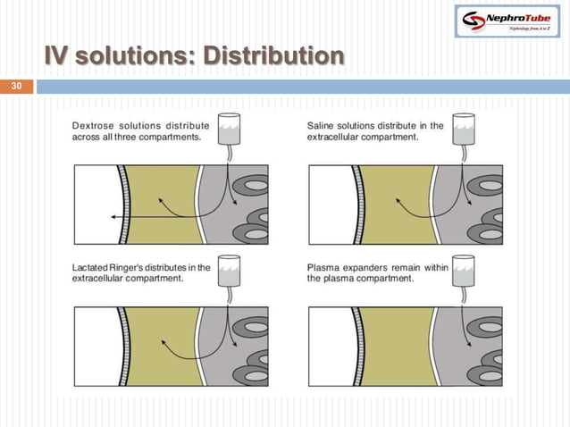 Renal Physiology (VI) - IV fluids (Applied physiology) - Dr. Gawad | PPTX