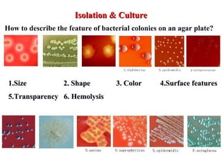 6 laboratory diagnosis of bacterial infection | PPT