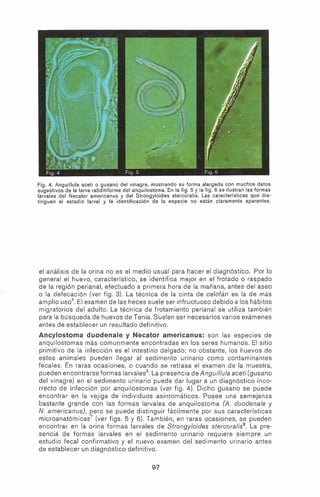 La orina al microscopio | PDF