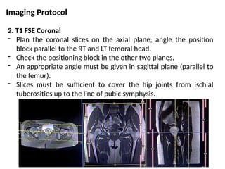 6- Lecture 6 Hip Imaging Protocol MRI .pptx