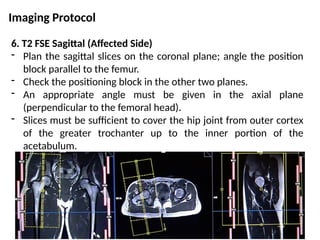 6- Lecture 6 Hip Imaging Protocol MRI .pptx