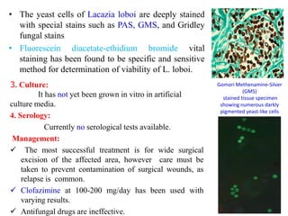 Lobomycosis , Rhinomycosis & Zygomycosis | PDF