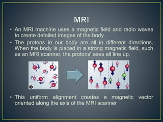 MRI | PPTX